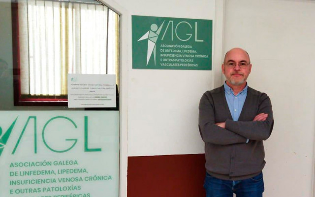 Que é o linfedema, unha doenza crónica que afecta a uns 100.000 galegos?